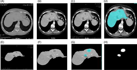 Segmentation Results Of Asymmetric Dilated Convolutional Download Scientific Diagram