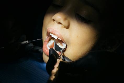 Gum Disease Treatment Options A Dentists Practical Guide