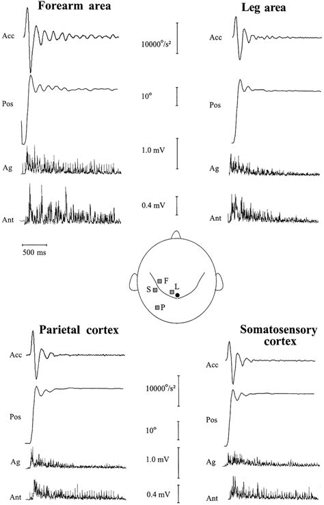 Effects Of Different Stimulus Positions On Rapid Wrist Extension