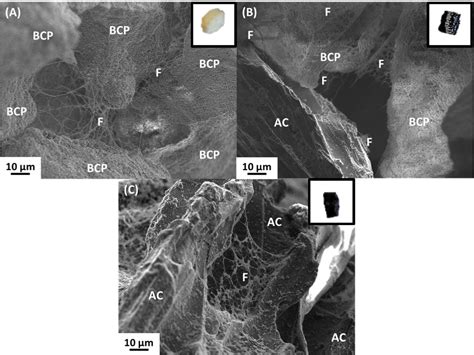 Figure 1 From Biphasic Calcium Phosphate And Activated Carbon