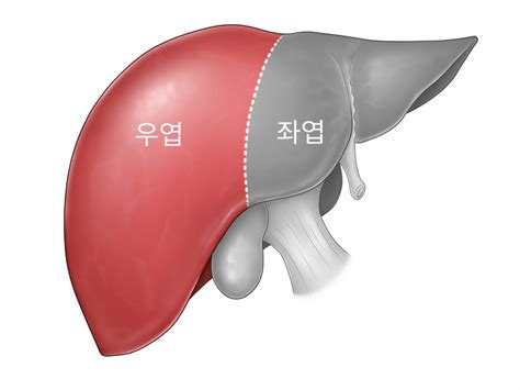 한국간담췌외과학회