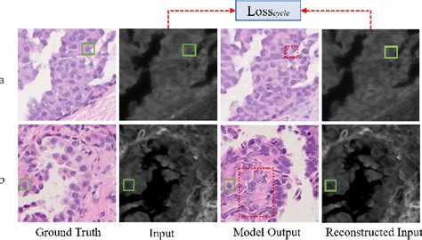 Figure 1 From One Side Virtual Histological Staining Model For Complex Human Samples Semantic
