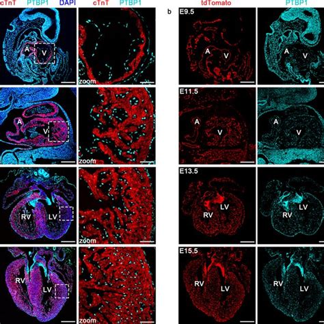 Ptbp1 Knockdown Affects Endothelial Cell Migration And Cardiomyocyte