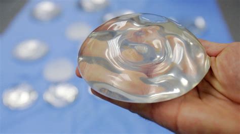 Fda Links Very Rare Cancer 9 Deaths To Breast Implants