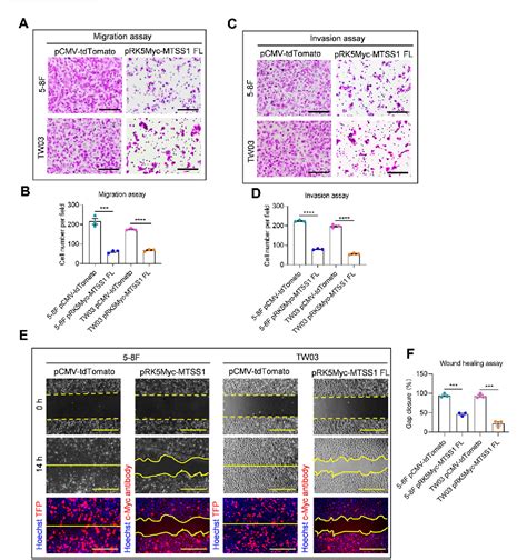 Figure 2 From Mtss1 Is Downregulated In Nasopharyngeal Carcinoma Npc