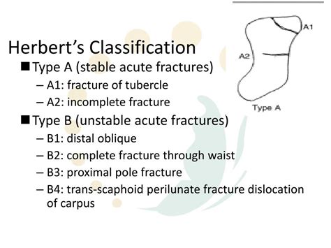 Ppt Scaphoid Fractures Powerpoint Presentation Free Download Id