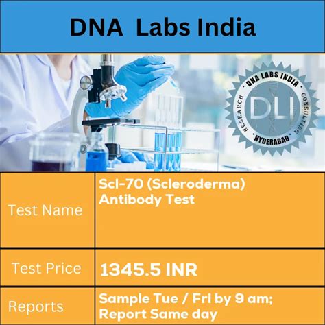 Scl 70 Scleroderma Antibody Test Cost 1345 5 Inr In India