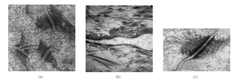 Transmission Electron Micrographs Of Desmosomes In Mouse Epidermis