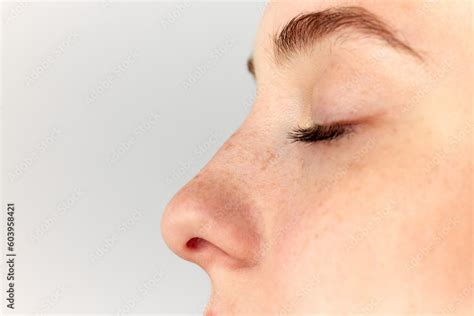 Young Woman Girl Demonstrating Nose After Before Surgery Over White