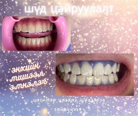 Энхийн Мишээл Шүдний эмнэлэг Ulaanbaatar