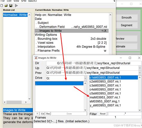 【matlab】spm数据处理matlab Spm Csdn博客