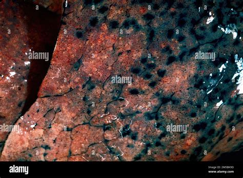 Close Up Of The Surface Of A Human Lung With Anthracosis A Disease