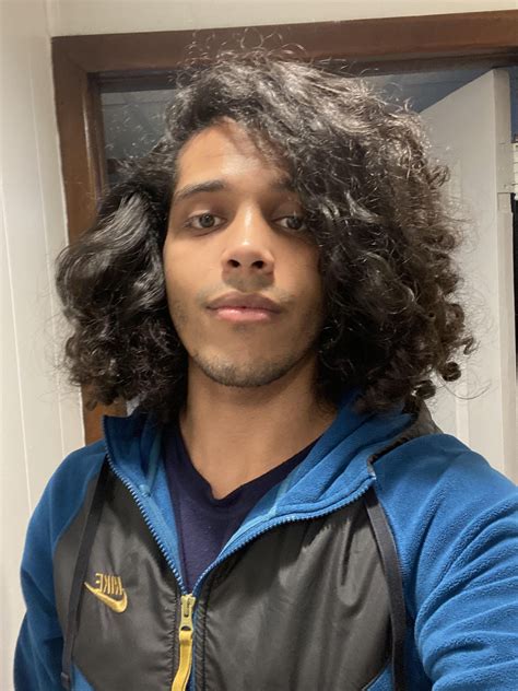Diagnosed With Female Pattern Hair Loss As A Male With Recent