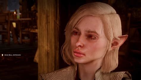 Lmao Albino R Dragonageinqusition