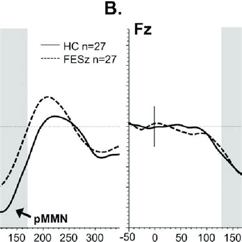Group Mismatch Negativity Grand Averages Information Previously Download Scientific Diagram