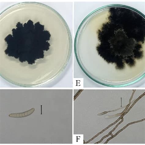 A D Morphological Features Of B Maydis Cfuenf 477 In Pda Culture