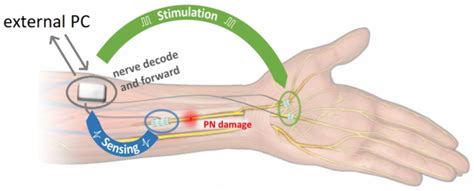 Figure 1 From Neural Network Based Classification Of Eng Recordings In Response To Naturally