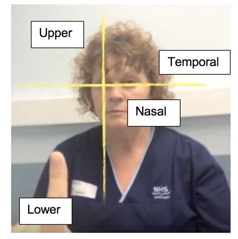 26 Clinical Techniques The Neurological Assessment Medicine Libretexts