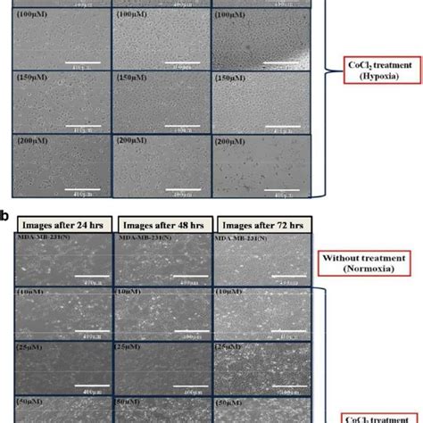 Cell Proliferation With Increase In Concentration Of Cocl 2 Mcf 7