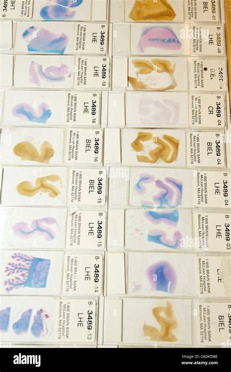 Human Brain Microscope Slides Microscope Slides Of Stained Sections Of Human Brain These