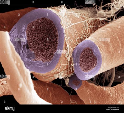 Myelinated Nerve Fibres Coloured Scanningelectron Micrograph Sem