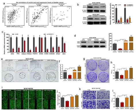 Sox2ot Promotes The Stemness Phenotype Of Bcsc By Modulating Sox2 A Download Scientific