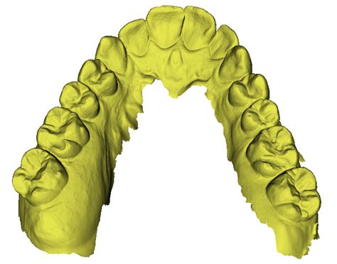 Slicerdentalmodelseg User Tutorial — Slicersalt Documentation Documentation