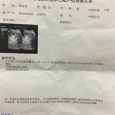 b超单数据 b超单子怎么看 随意云