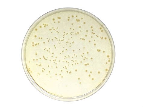 Three Key Steps To Transforming Bacteria Minipcr Bio