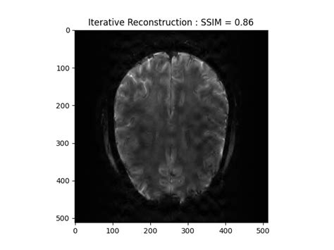Neuroimaging Cartesian Reconstruction — Pysap V021