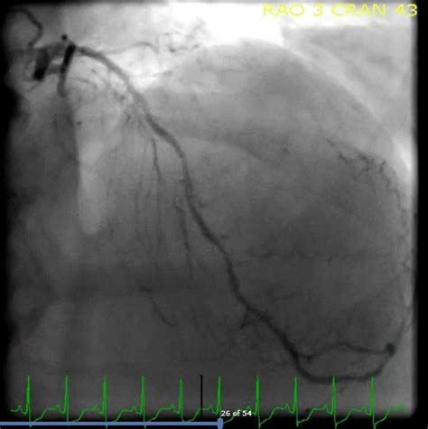 Dr Smiths Ecg Blog