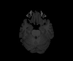 Brain Mri Segmentation Via Region Based Active Contour Segmentation