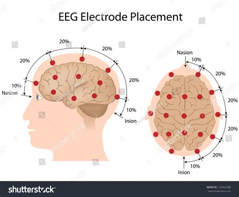 Eeg 전극 배치 스톡 일러스트 129464789 Shutterstock