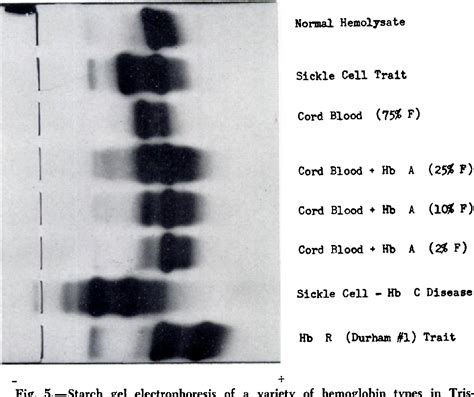 Figure 1 From The Amino Acid Composition Of Hemoglobin V The