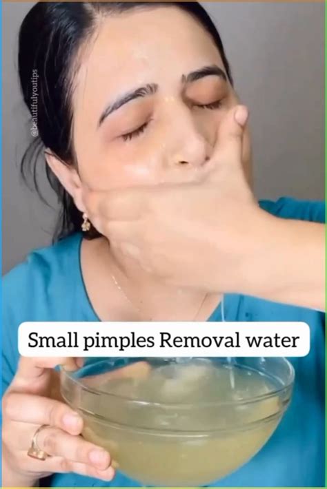 Small Pimples Removal Skincare Small Pimples How To Get Rid Of Pimples Glow Up Tips