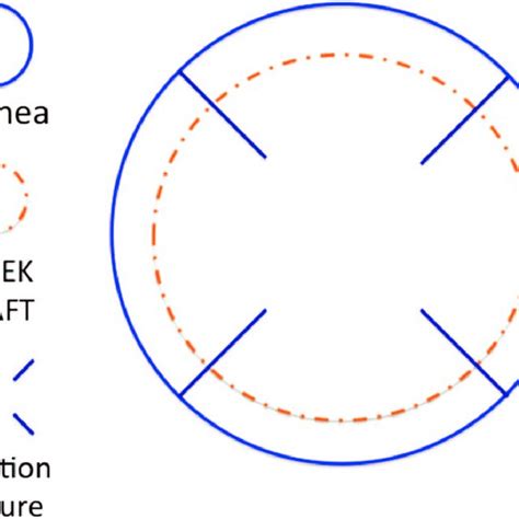 Four Fixation Radial Sutures With Nylon Were Applied In Download Scientific Diagram