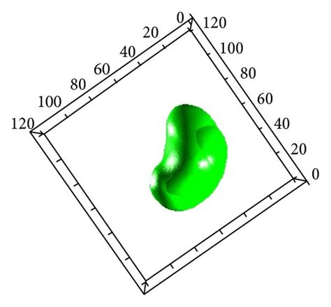 3D Visualization Of Segmentation Results A Axial View B Coronal