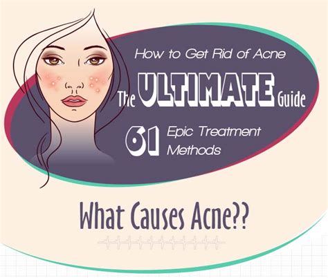 How To Get Rid Of Pimples Fast 61 Treatment Methods Infographic