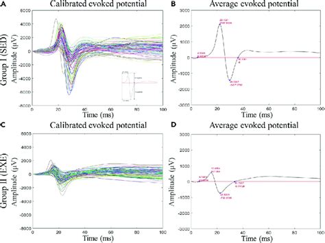 Ecog Recorded Electrical Stimulation Electrical Stimulation Was
