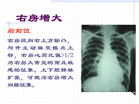 Ppt