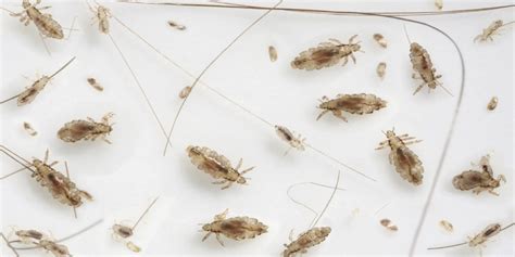 Lice