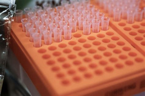 Msk Researchers Discover Targetable Mechanism Driving Late Cardiac