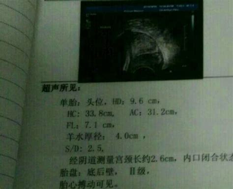 b超单 hc ac是什么 随意云