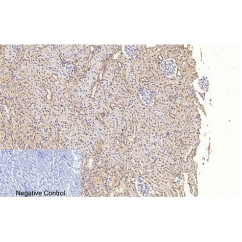 Cleaved Caspase 3 P17 D175 Polyclonal Antibody
