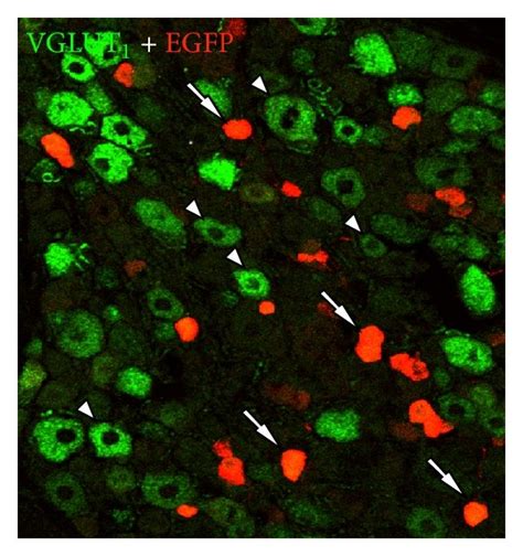 Frequent Coexpression Of Vglut 2 Or Egfp Vglut 3 With Th Or Vglut 2 Download Scientific