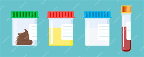 모자가 있는 벡터 테스트 튜브 세트 대변 혈액 소변 정자 약국 치료 그림 프리미엄 벡터