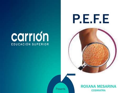 Caract3risticas De Pefe Celulitis 12pdf