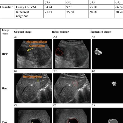 Performance Comparison Of Svm And Knn Classification Techniques At