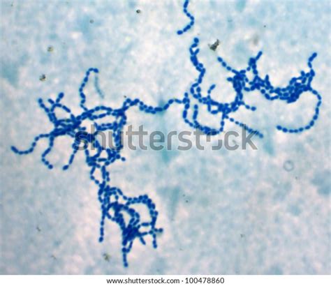 Streptococcus Pyogenes Images Stock Photos D Objects Vectors Shutterstock