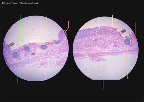 Ileum Of Small Intestine Histology 2 Diagram Quizlet